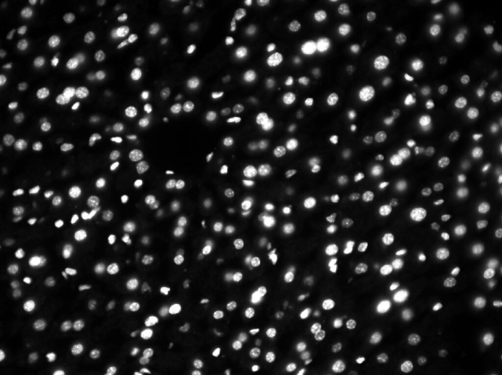 2D Automated Analysis | Image Pro | Media Cybernetics