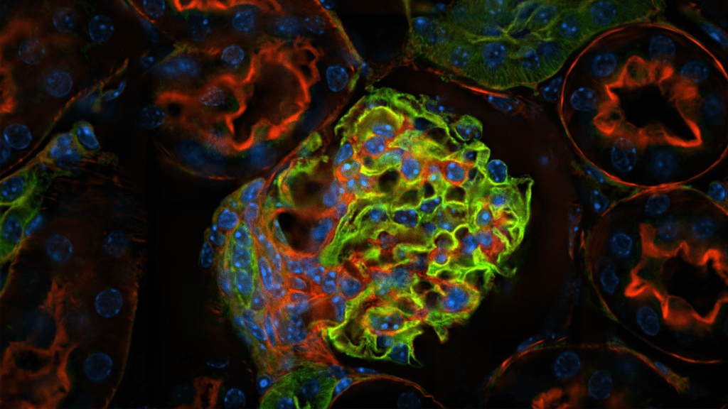 AutoQuant Deconvolution | Image-Pro | Media Cybernetics