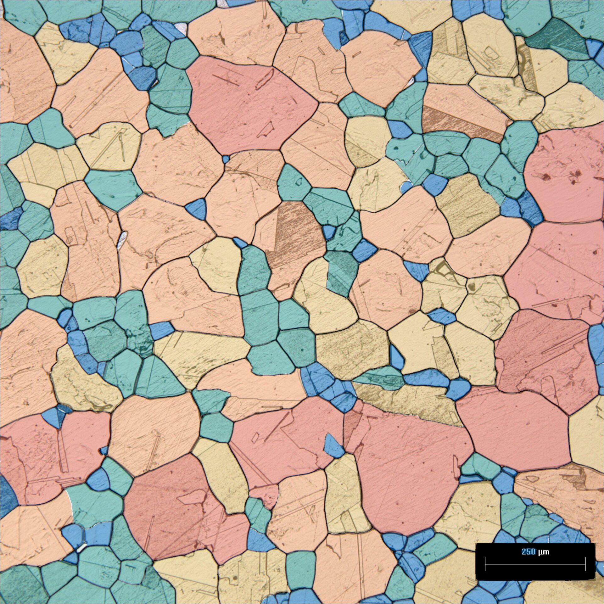 Grain Size (ASTM E112 Segment Method) - Media Cybernetics